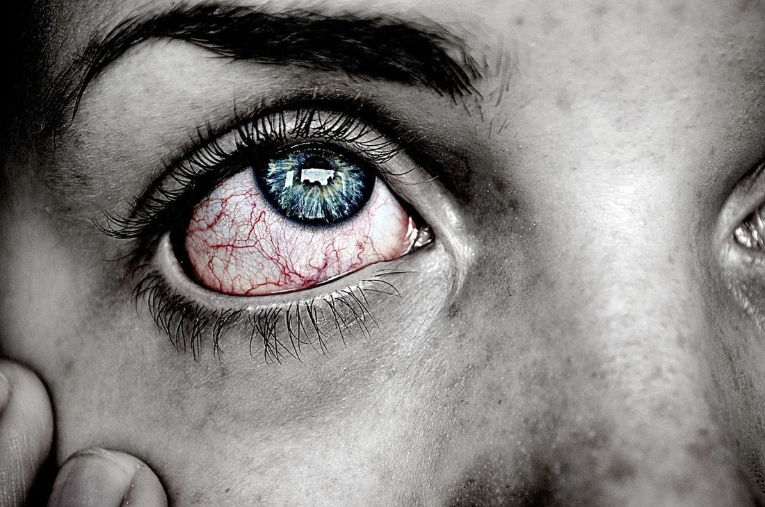 Weed Eyes: The Science of Red Eyes and Cannabis | Learn More | Munchies!