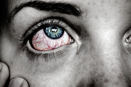 Weed Eyes: The Science of Red Eyes and Cannabis | Learn More | Munchies!